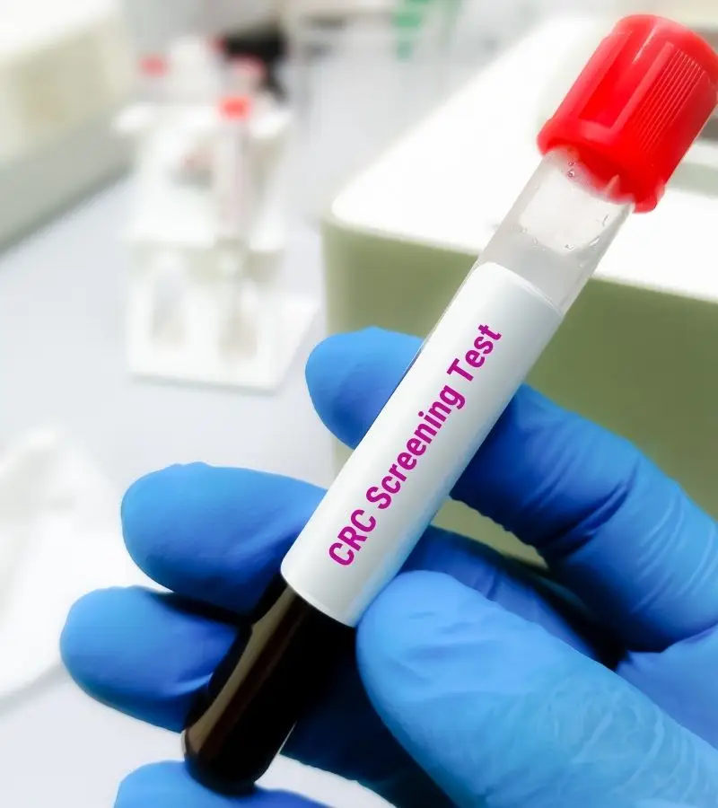 ColonAiQ® Asia – Advanced Colorectal Cancer Screening